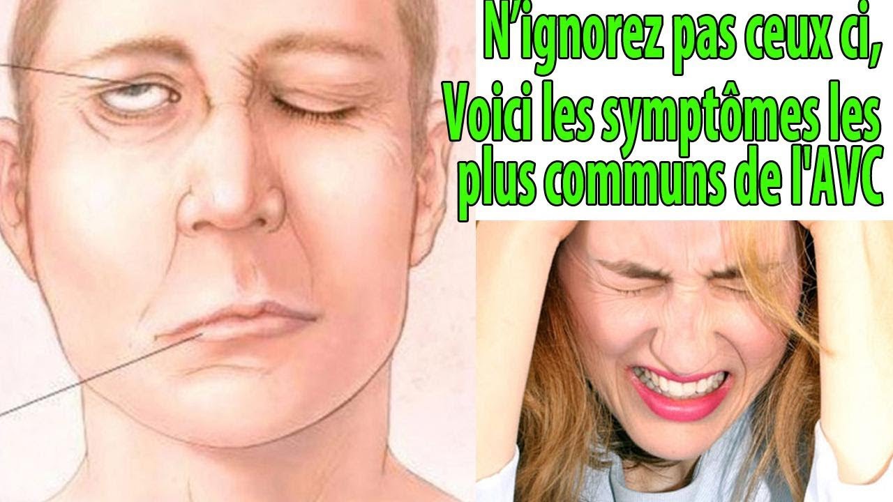 N’ignorez pas ceux ci, Voici les symptômes les plus communs de l'AVC ...