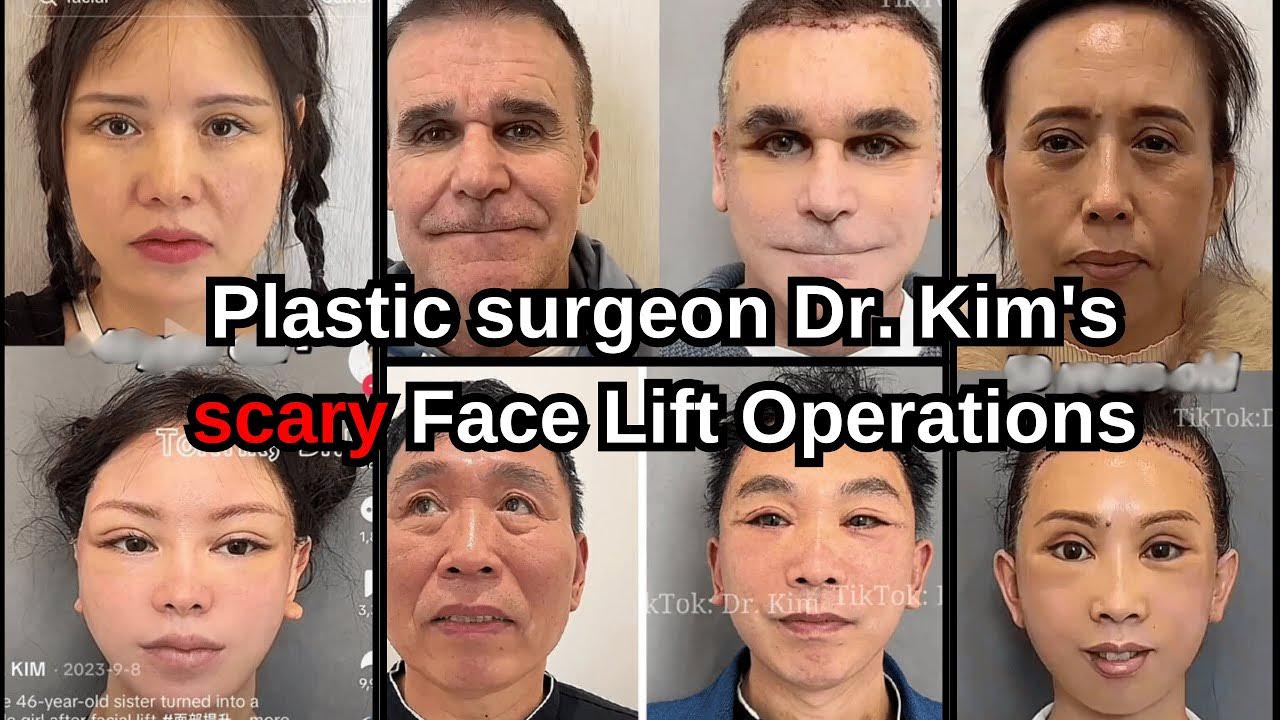 Plastic surgeon Dr. Kim's scary Face Lift Operations - YouTube