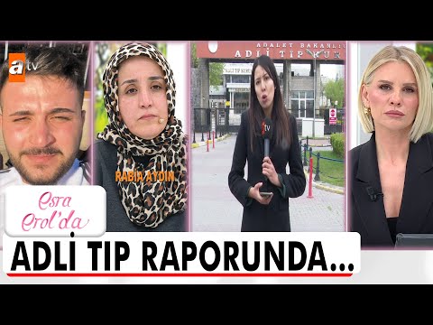 Deforme olan cansız beden Adli Tıp Kurumu'na getirildi! - Esra Erol'da 14 Nisan 2025