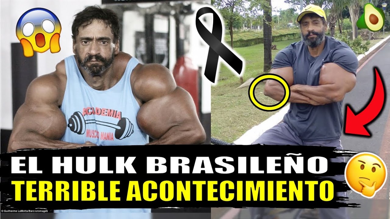 ESTO PASO!! Valdir Segato DE QUE MURIO + LA VERDAD del Hulk Brasileño ...