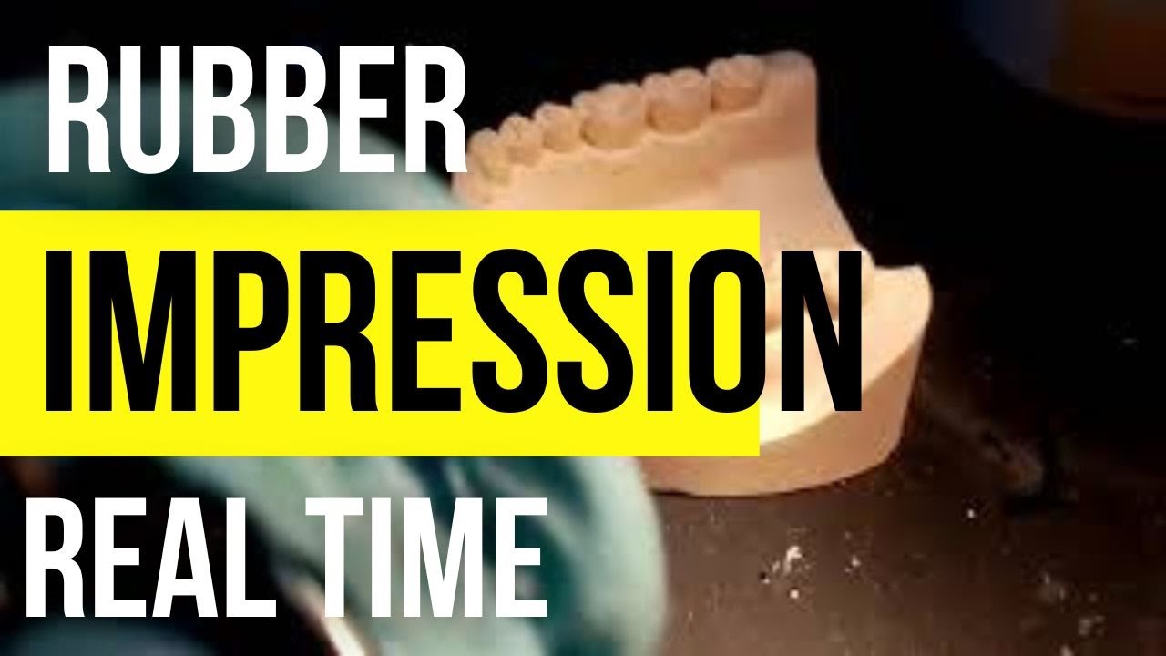 How To Use Rubber Impression Using Partial Tray - Real Time - YouTube