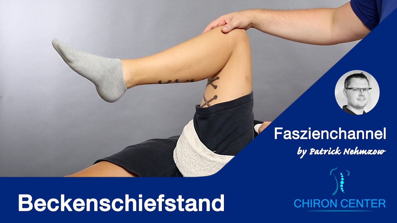 Beckenschiefstand, Beinlängendifferenz, was kann ich tun? - YouTube