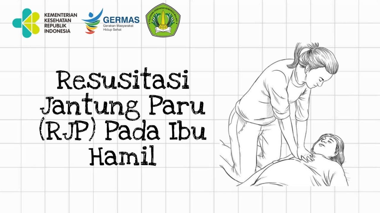 RESUSITASI JANTUNG PARU (RJP) PADA IBU HAMIL - YouTube