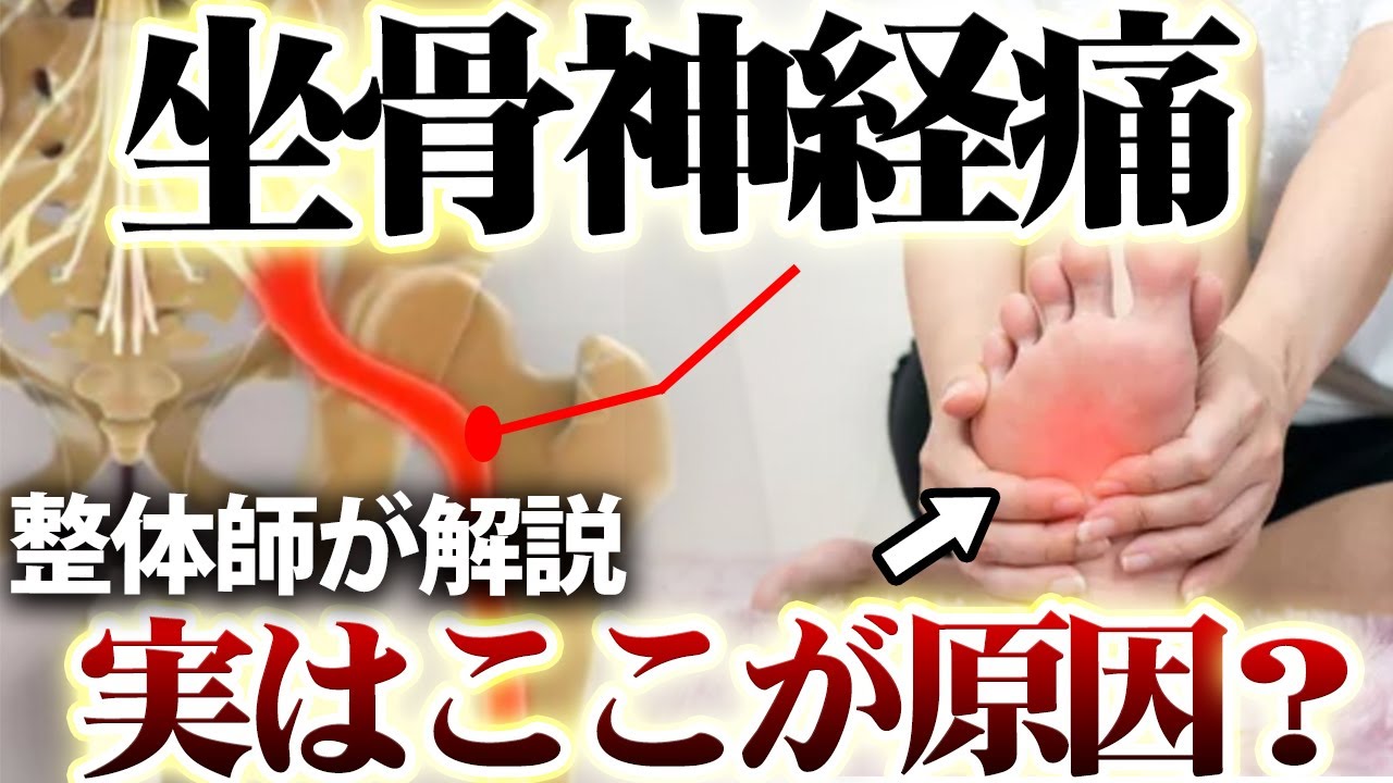 坐骨神経痛は足裏で解消!?見るだけでわかる仕組みと原因! Youtube