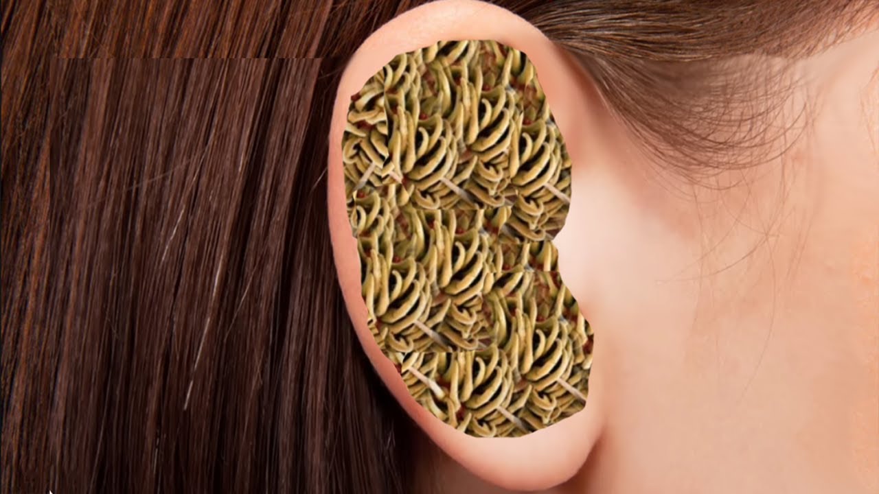 ASMR Animation treatment from infected foot | ASMR Treatment Animation ...