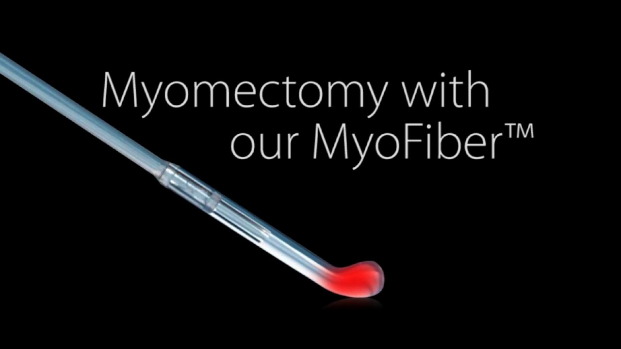 PHD Produtos Hospitalares: Biolitec - Myomectomy and Polypectomy with ...