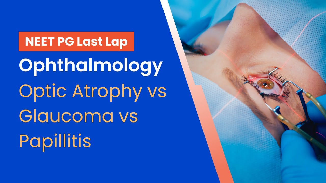 NEET-PG Prep | Ophthalmology | Optic Atrophy vs Glaucoma vs Papillitis ...