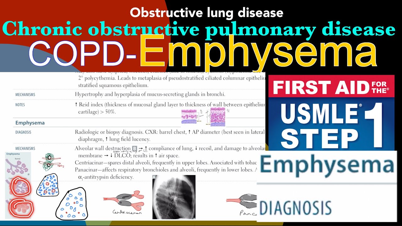 Obstructive lung disease- COPD- Emphysema in Hindi/Urdu by first aid ...