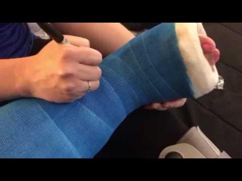 Bootzy signing her leg cast - YouTube
