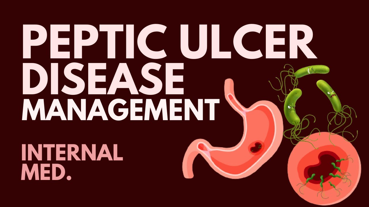 Management of Peptic Ulcer Disease - YouTube