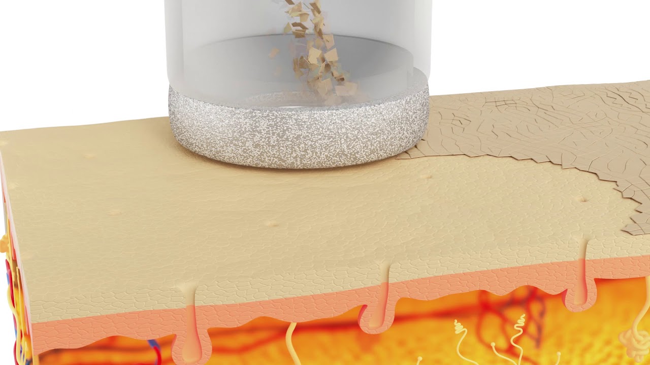 Watch To See How The Diamond Tip Works - YouTube