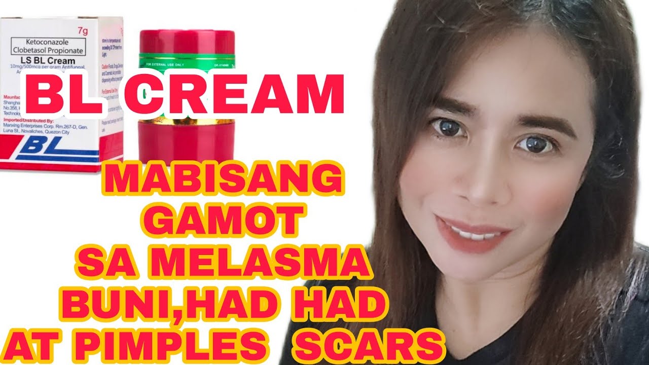 BL CREAM PINAKA MABISANG GAMOT SA MELASMA ,PEKAS, BUNI AT HADHAD ||JEAN ...