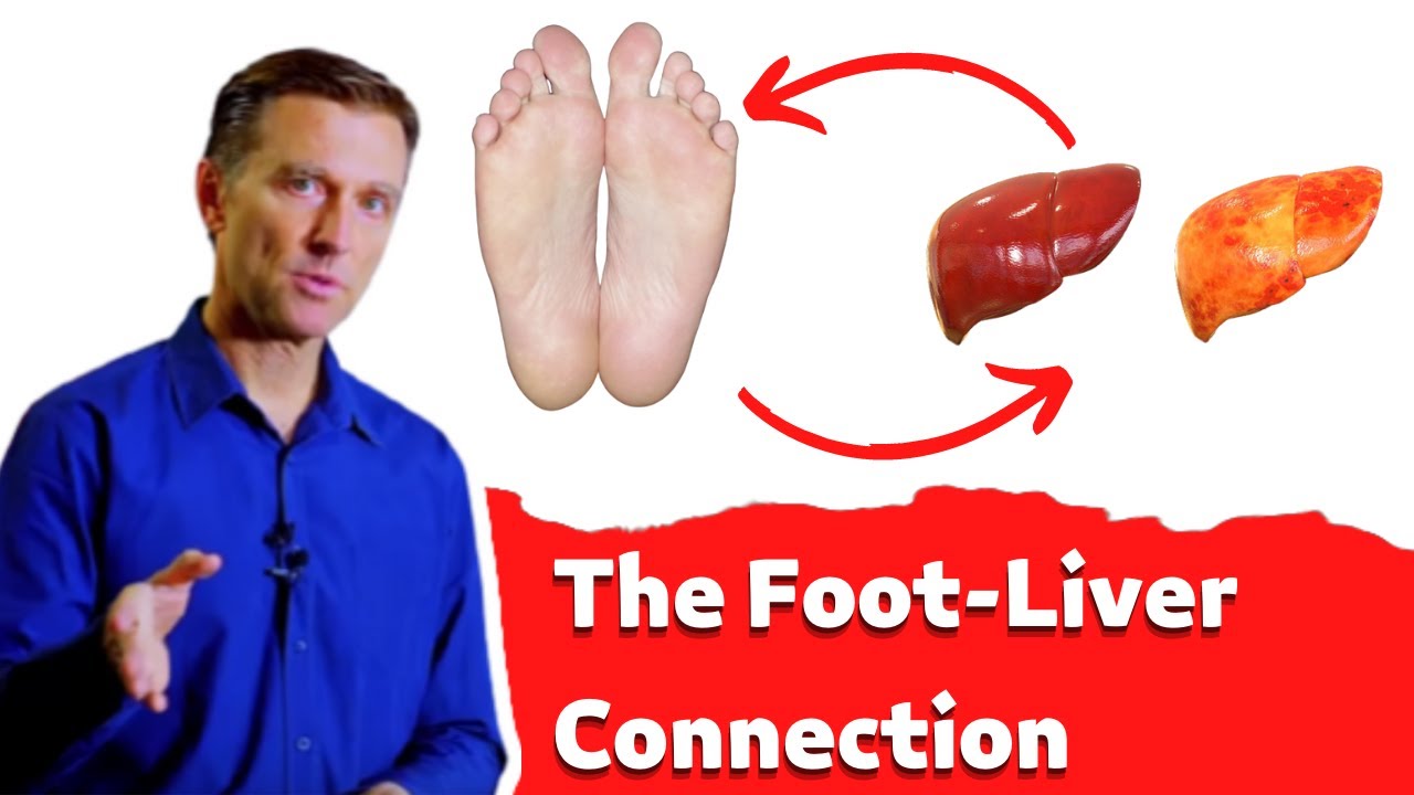 What Your Feet Can Tell You About Your Liver Problems – Dr.Berg - YouTube