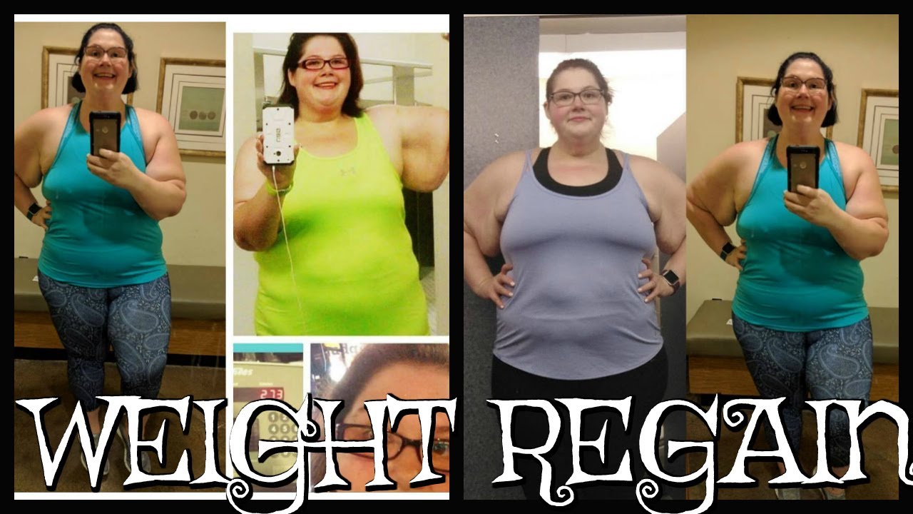 Let's Talk Regain & Plastics | Gastric Bypass RNY VSG DS WLS - YouTube