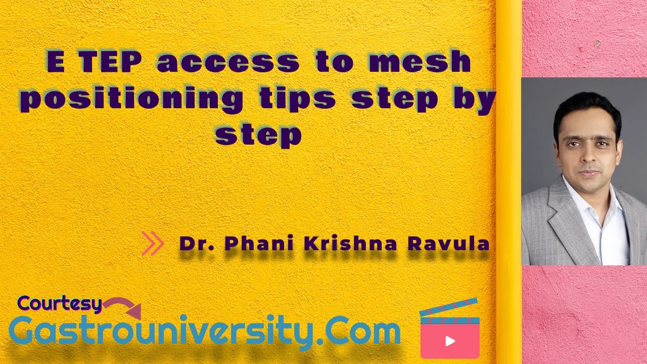 Hernia-e TEP Video guide – from eTEP access to mesh positioning tips ...