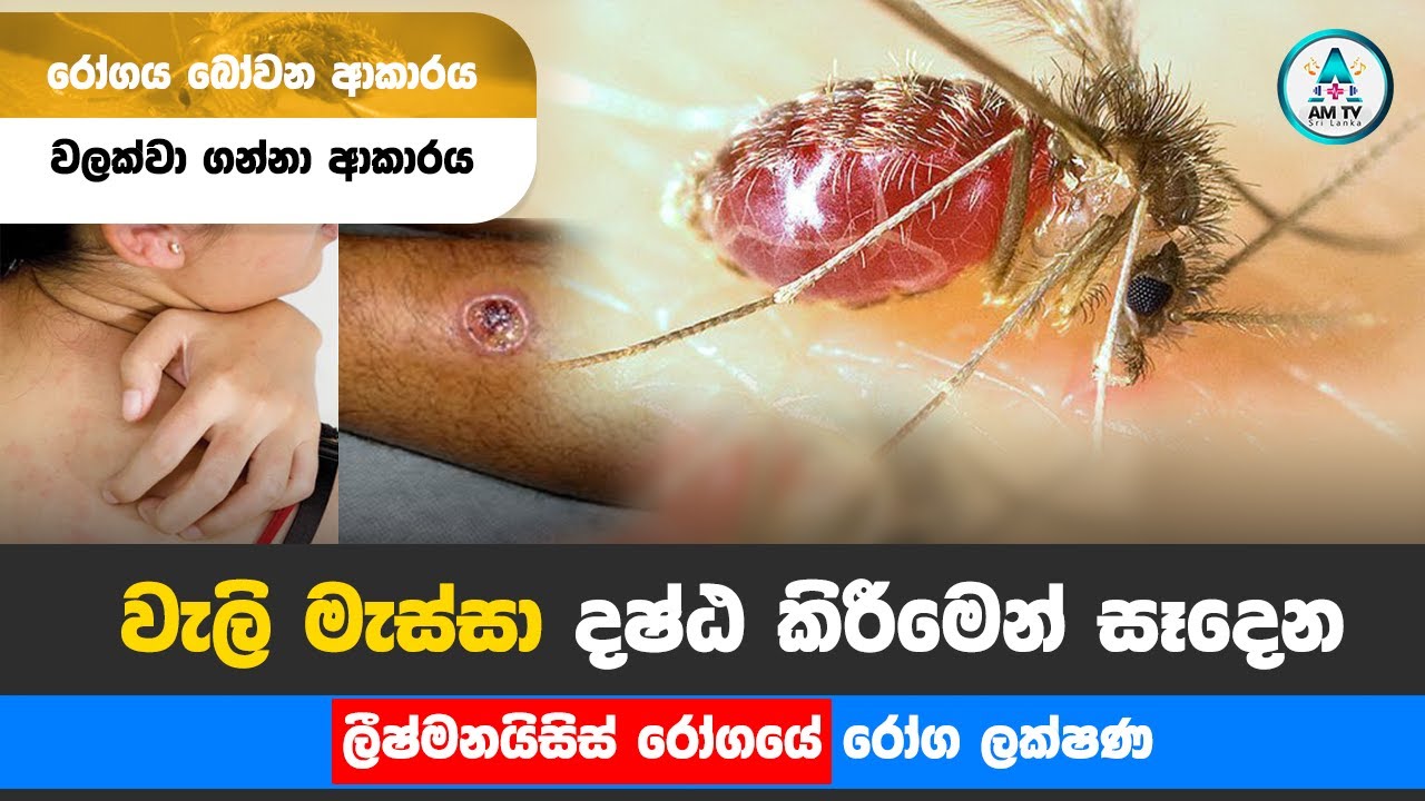 වැලි මැස්සා (Sand fly ) දෂ්ඨ කිරීමෙන් සෑදෙන ලීෂ්මනයිසිස් රෝගය ...