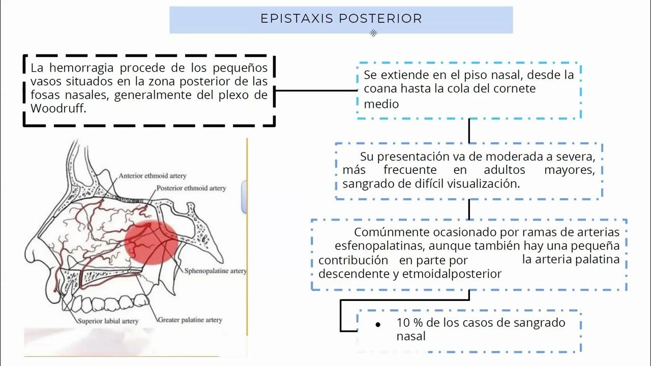 EPISTAXIS ANTERIOR Y POSTERIOR - YouTube