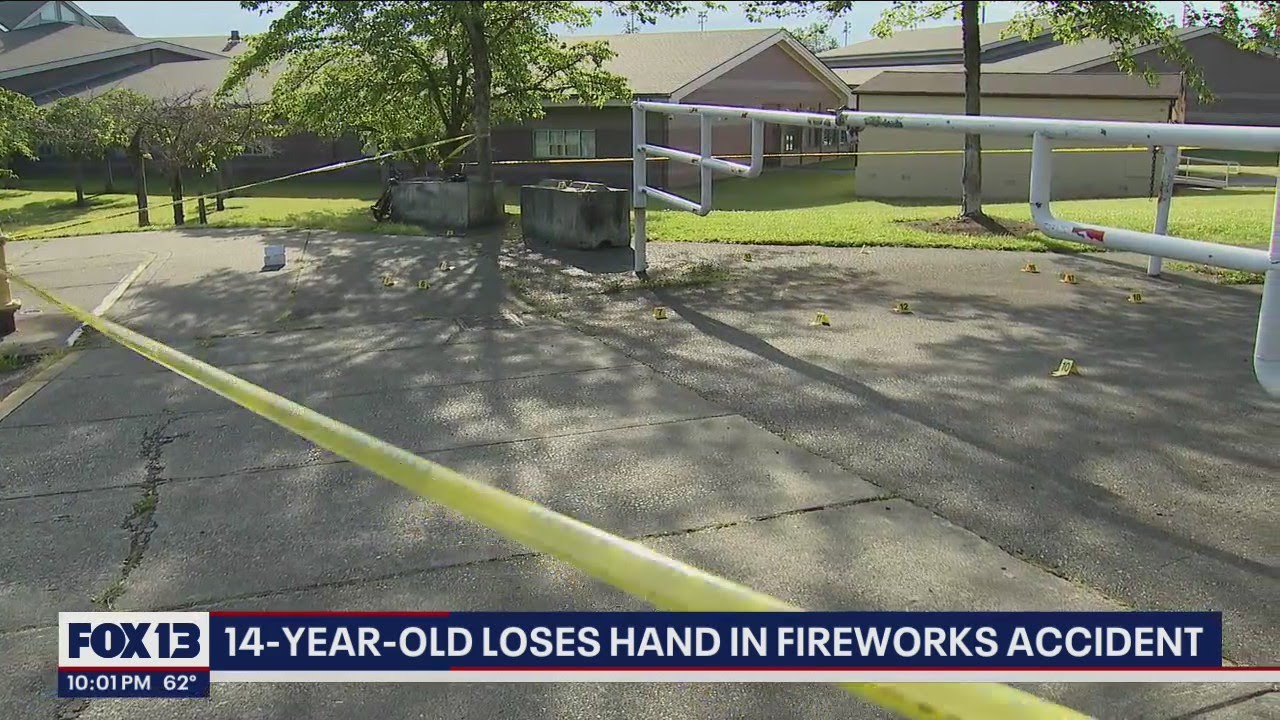 14-year-old loses hand in fireworks accident | FOX 13 Seattle - YouTube