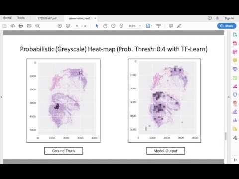 Detecting Cancer Metastases on Gigapixel Pathology Images - YouTube