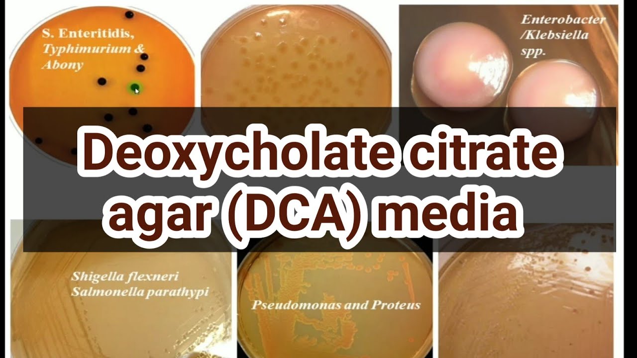 Deoxycholate Citrate agar (DCA) media: culture media lecture 33 - YouTube