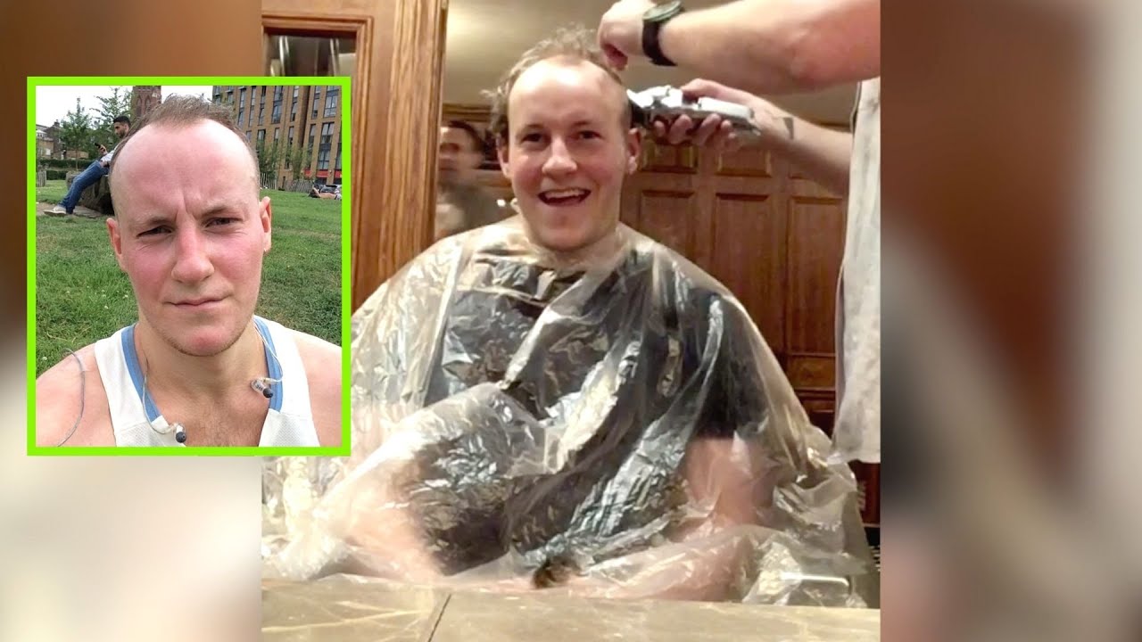Going FULL BALD In my 20's After Dealing With Balding for Years - YouTube