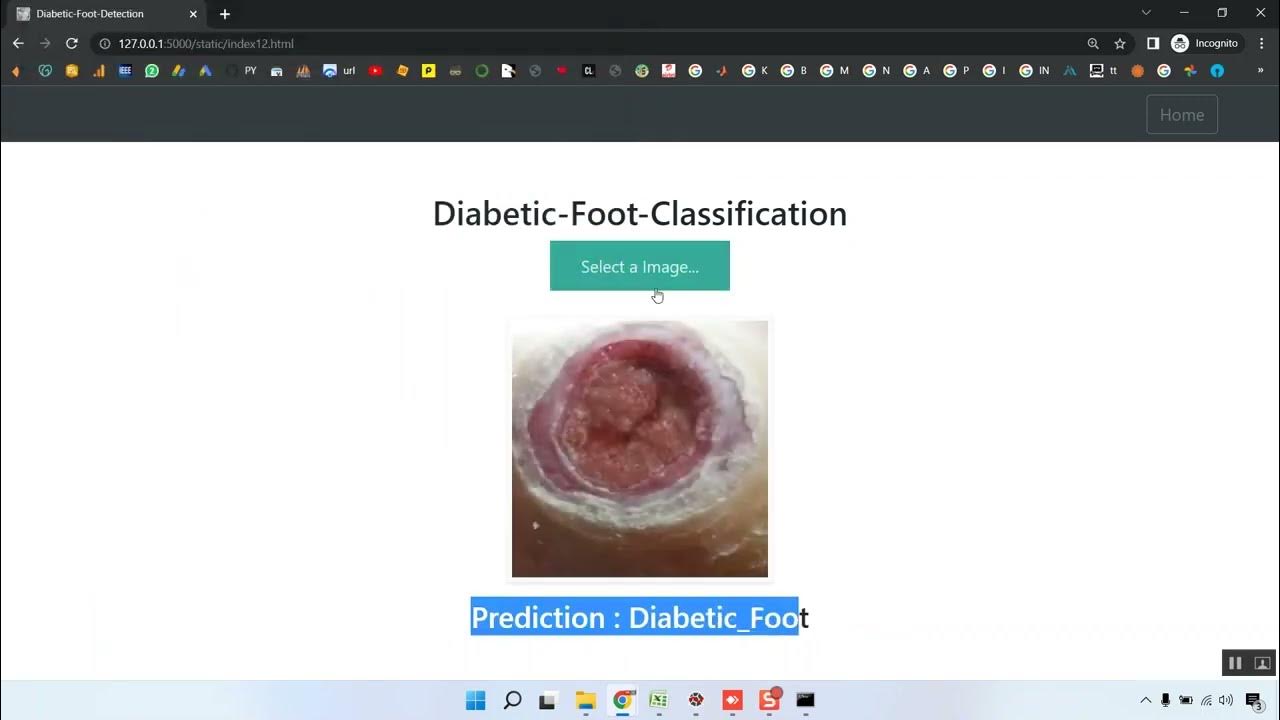 Diabetic Foot Ulcer Ischemia and Infection Classification Using ...