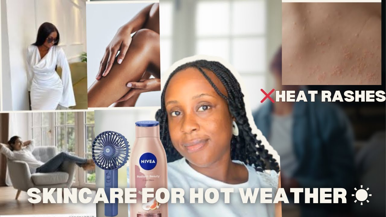 SKINCARE FOR HOT WEATHER 🌞causes and prevention of heat rashes - YouTube