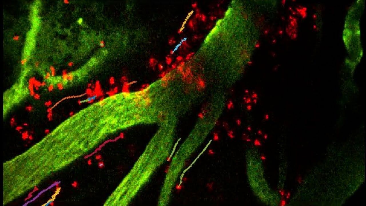 V-061:InVivo Imaging Capture Cerebral Hemorrhage that Alters ...