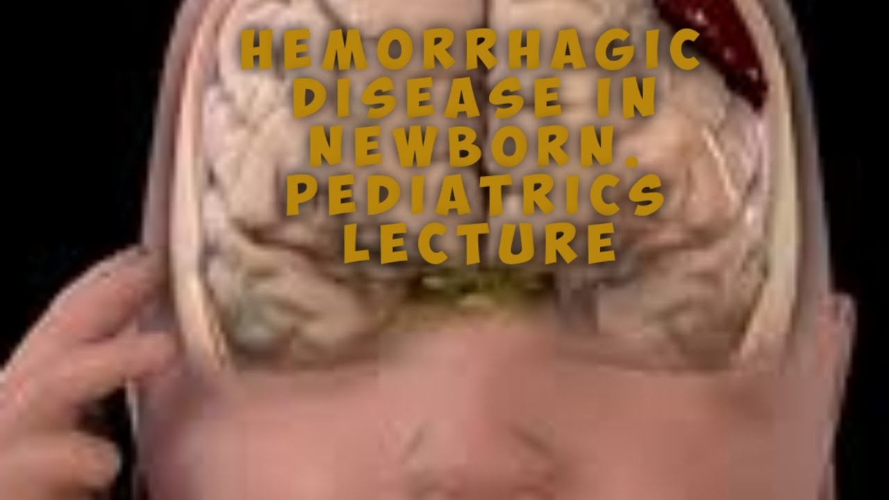 Hemorrhagic Disease In Newborn Pediactric Lecture - YouTube