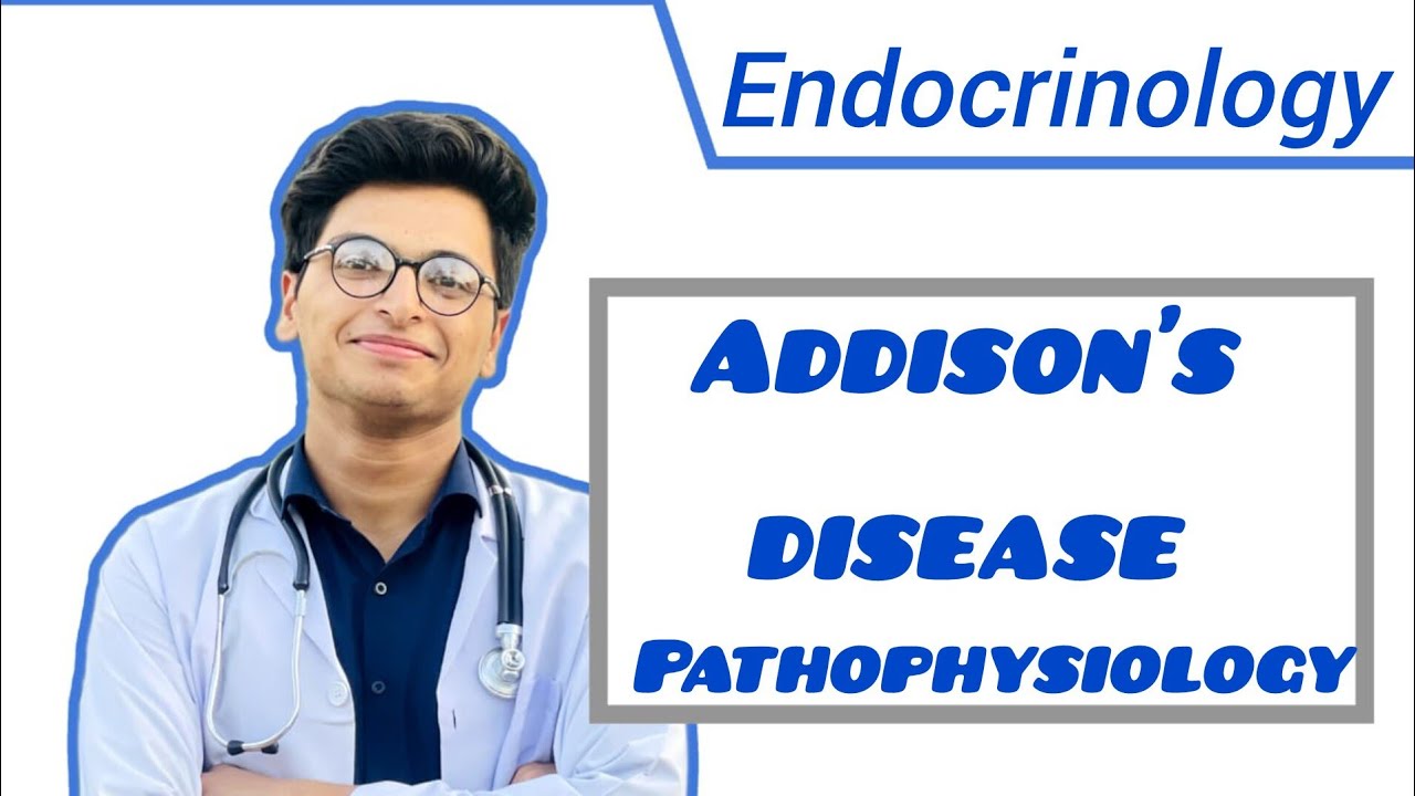 Addison's disease pathophysiology || Causes; Symptoms; Treatment - YouTube