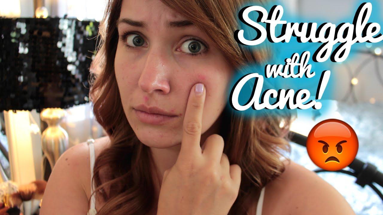 My Struggle with Acne | Chat & Get Ready with Me! - YouTube