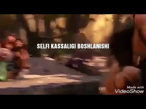 Prikol. Selfi kassaligini boshlanishi