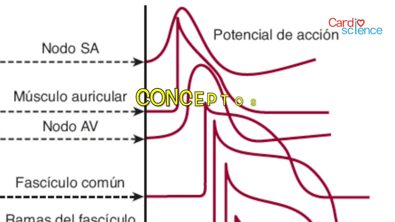 MODULO 10 4 1 RITMOS DE ESCAPE Y EXTRASISTOLES VENTRICULARES - YouTube