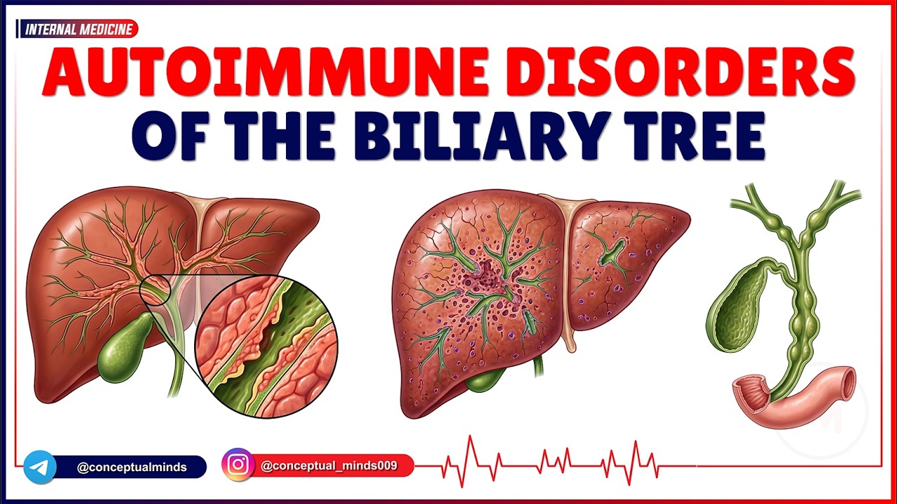Autoimmune Disorders of the Biliary Tree | USMLE Step 2 CK | Internal ...