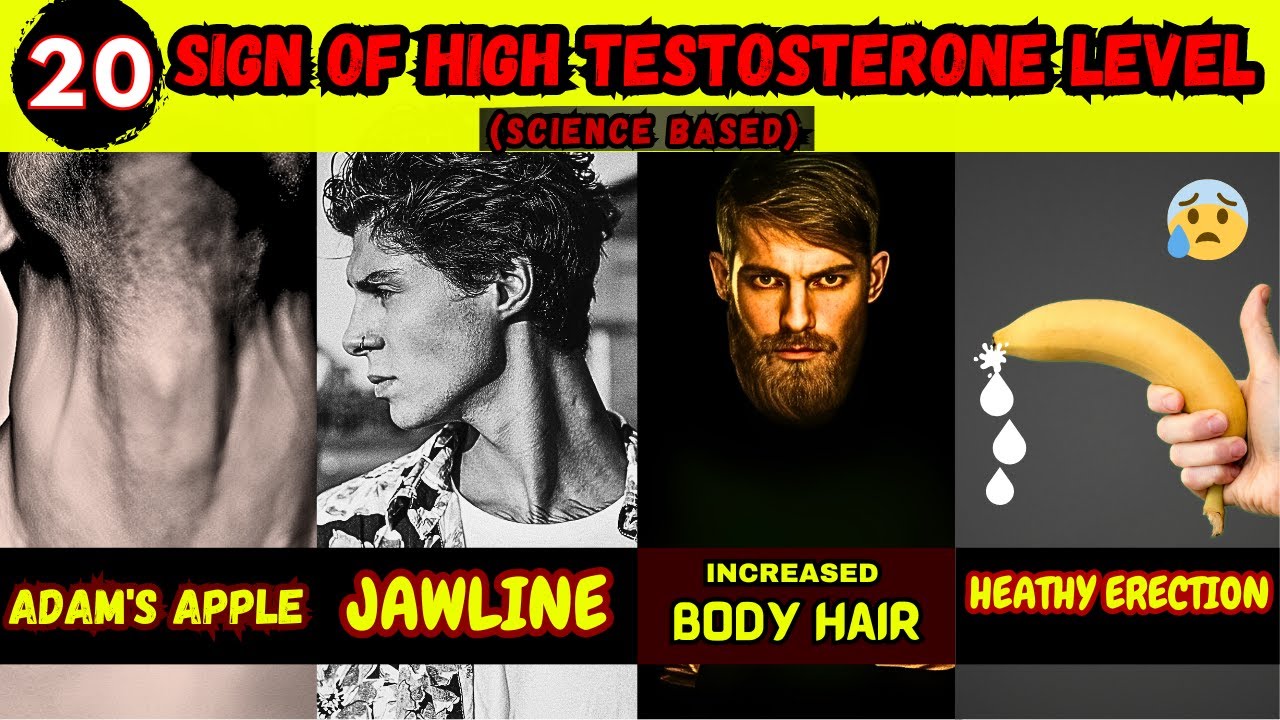 Top 20 Signs of High Testosterone in a Men | Symptoms of High ...