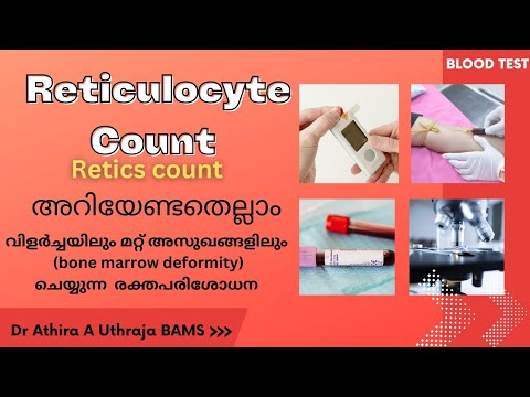 Reticulocyte count|retics|Reticulocyte malayalam|blood test malayalam ...