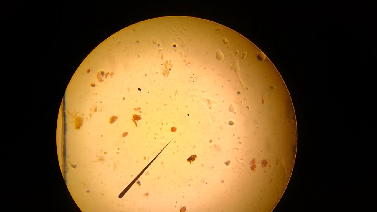 Balantidium Coli Trophozoite and Cyst - YouTube