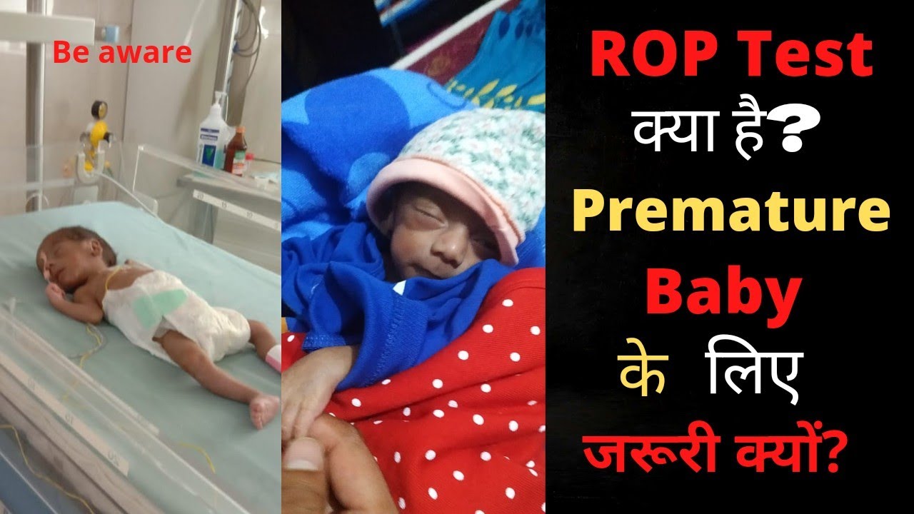ROP Test kya hai? Premature baby ke liye जरूरी क्यों?#prematurebaby # ...