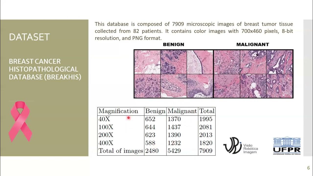 Convolutional Neural Network for Breast Cancer Diagnosis with Histology ...