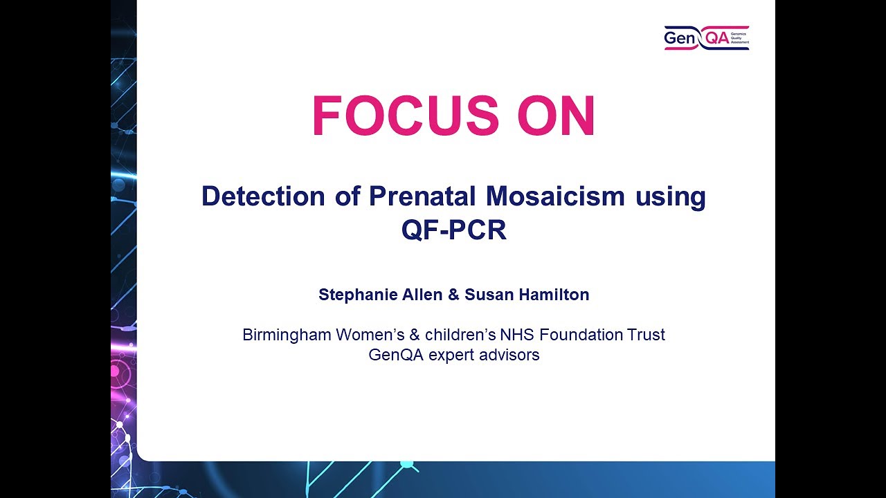 GenQA Detection of Prenatal Mosaicism using QF PCR on 25th November ...