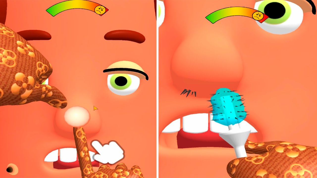 Pimple Cleaner Games Full Level Android and IOS #4 - YouTube