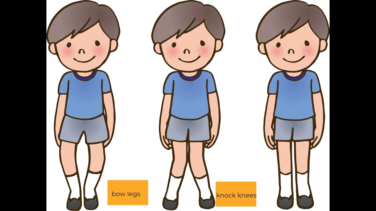 Bow Leg Correction Exercise | धनुष लेग सुधार अभ्यास | Anubhuti and ...