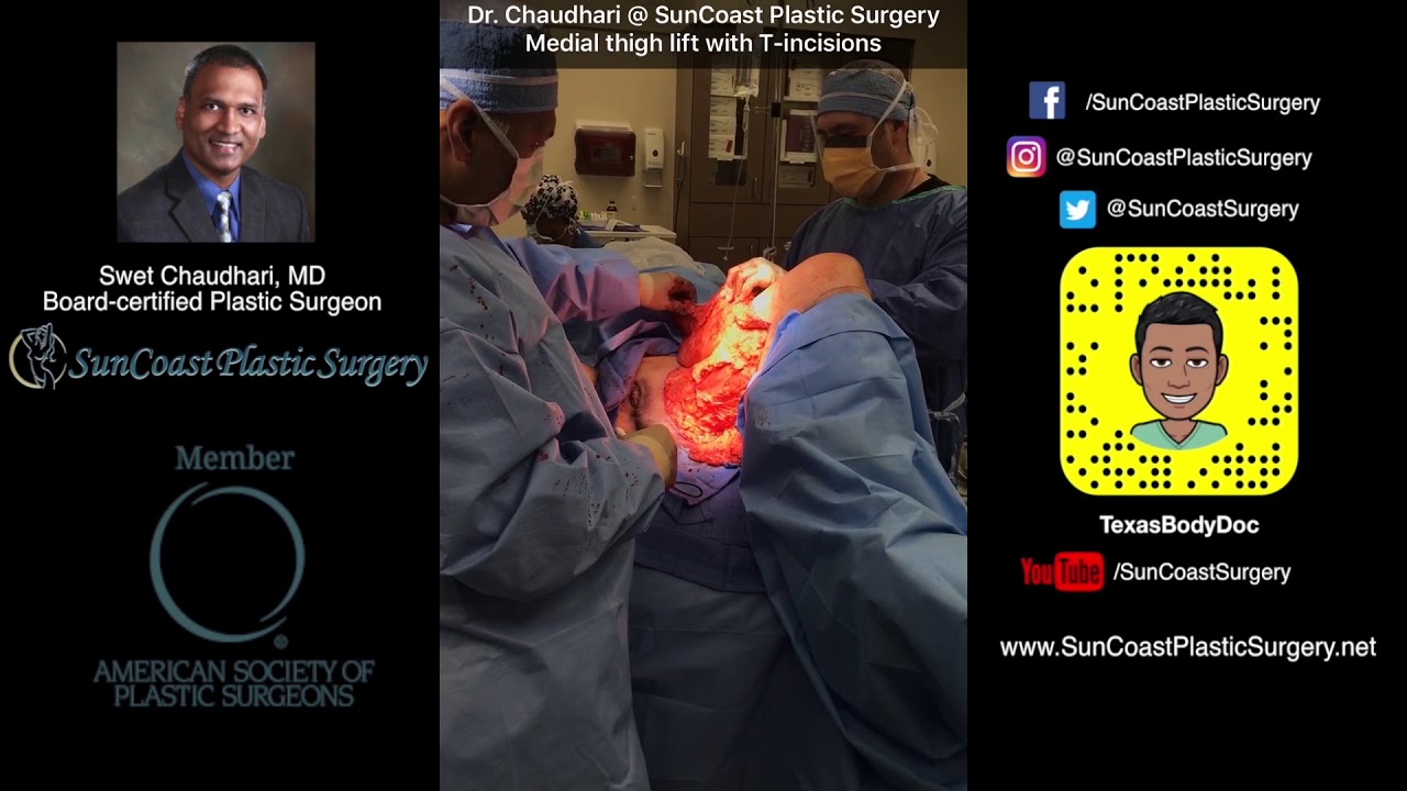 Medial Thigh Lift with T-incisions - YouTube