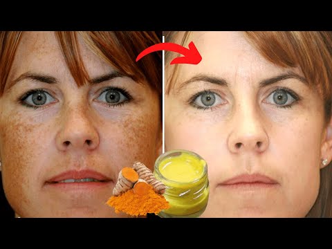 Büyülü Zerdeçal Krem - 3 gün içinde pigmentasyonu, koyu lekeleri, çilleri ve melazmayı çıkarır !!!