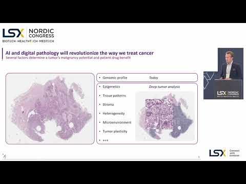 AI and digital pathology will revolutionize the way we treat cancer ...
