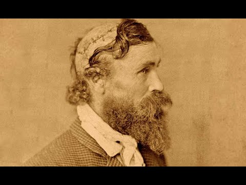 SCALPED by Indians. The Incredible Story of 13-Year-Old Robert McGee ...