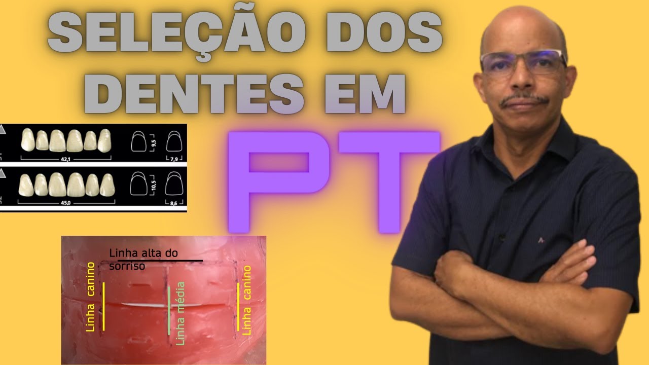 Como escolher os dentes em Prótese Total - YouTube
