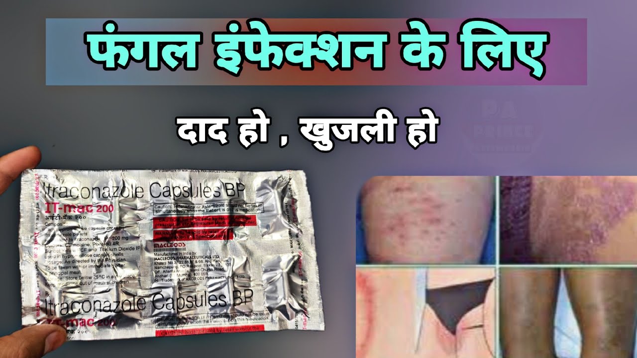 itraconazole capsules 200 mg | itroconazole capsule | it mac 200 ...