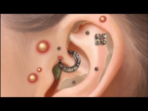 16 teen Girl! Ear makeup live⛑️ first time on YouTube lets see deep omg ...