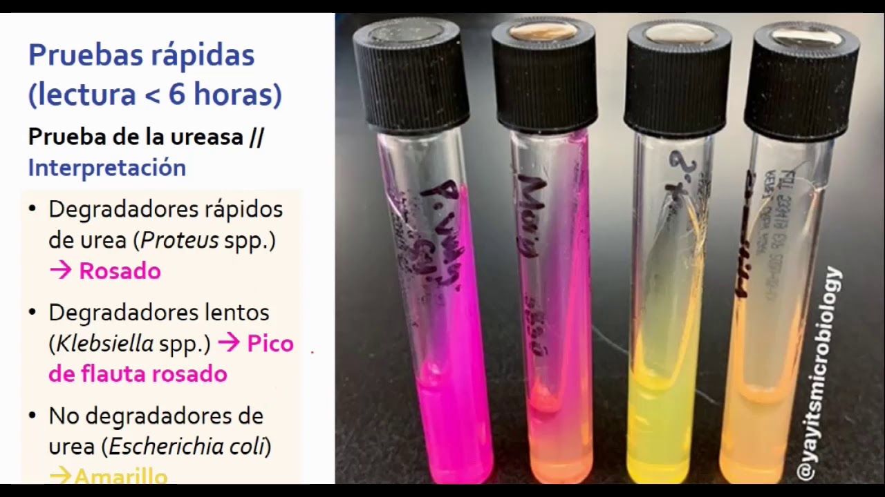 Pruebas Bioquímicas II: Coagulasa | Ureasa | Indol - YouTube